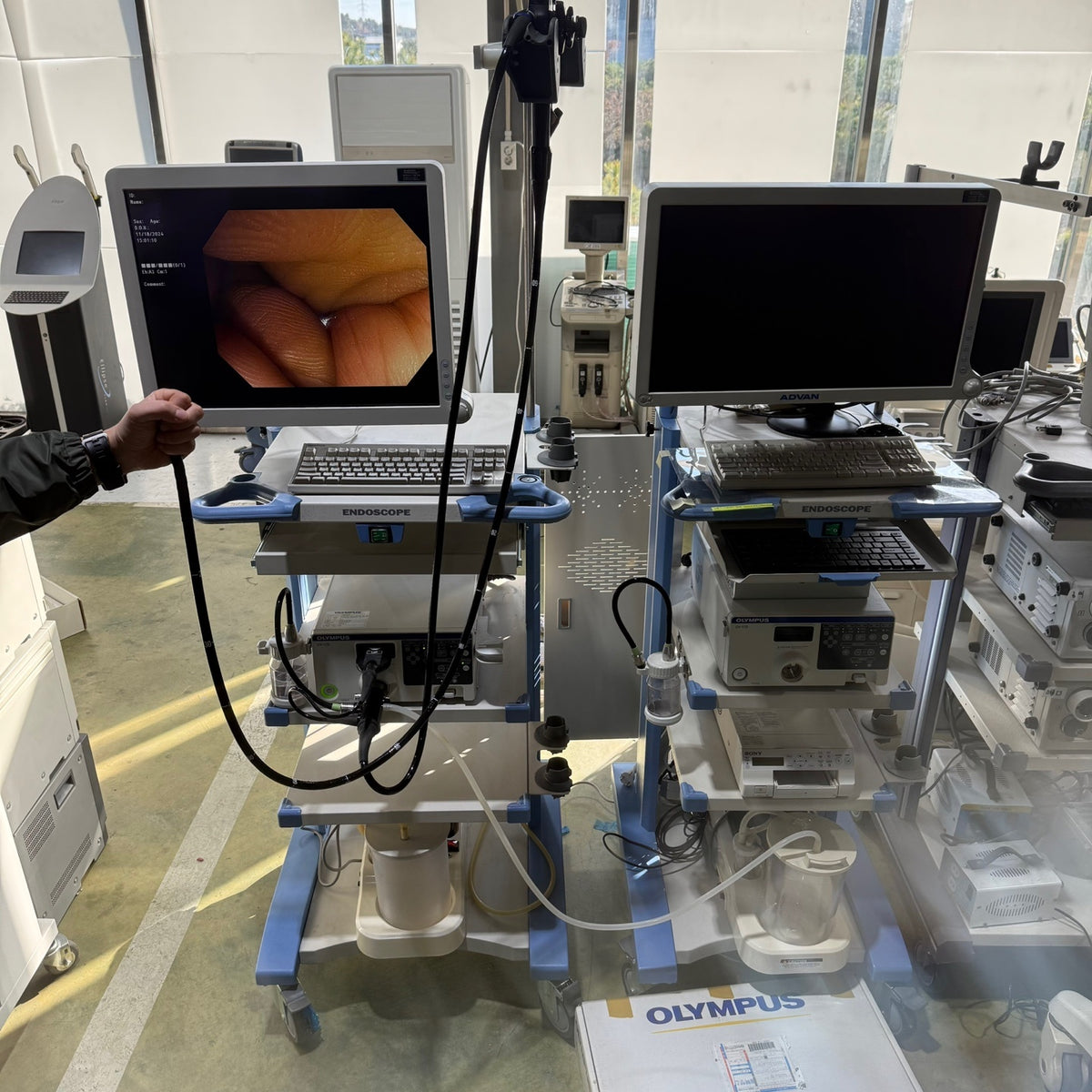 Used Olympus CV170 GIF H170 Gastroscope Full Endoscope System ...